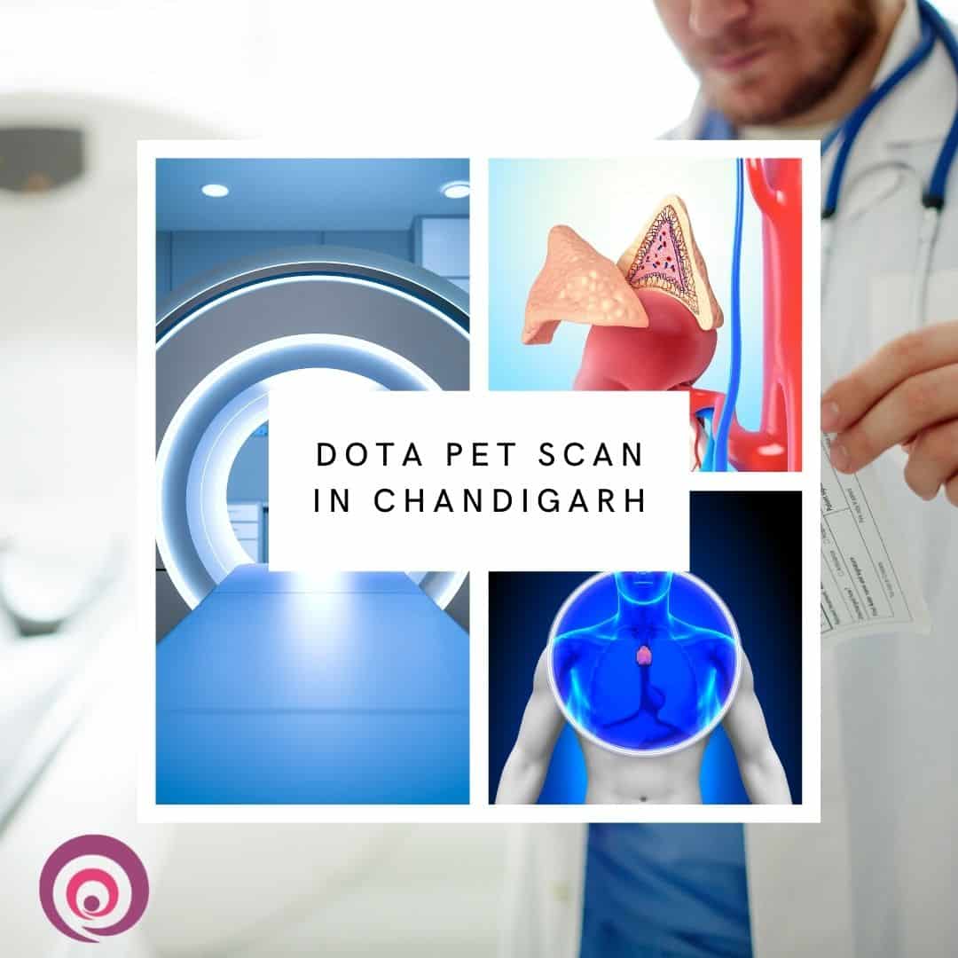 DOTA PET Scan in Chandigarh - MRI Chandigarh +918699572364