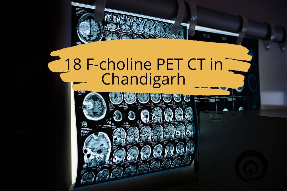 PET Choline in Chandigarh - MRI Chandigarh +918699572364