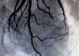 Cardiac Pet Scan in Chandigarh at best price