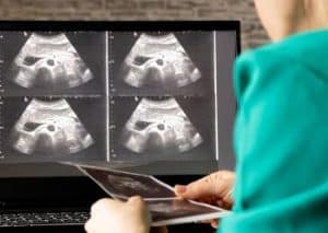 DMSA Renal Scan Archives - MRI Chandigarh