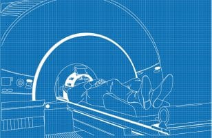 Does MRI Dye Have Side Effects? - MRI Chandigarh