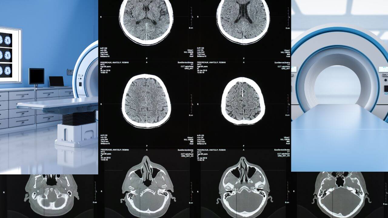 What Does a 3T MRI Show? - MRI Chandigarh