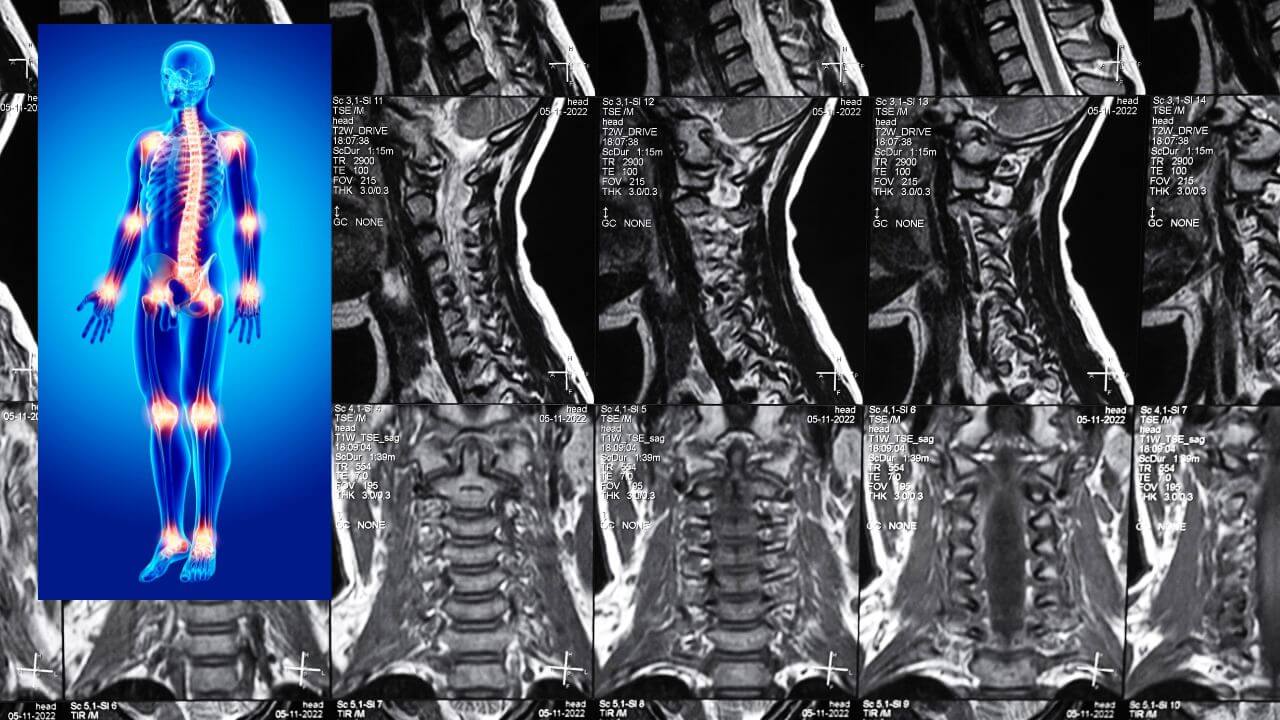 What Does a 3T MRI Show? - MRI Chandigarh