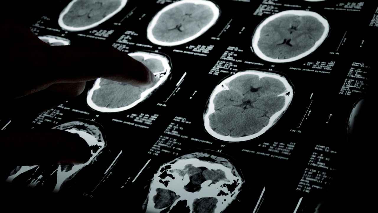 PET Scan With Contrast For Cancer